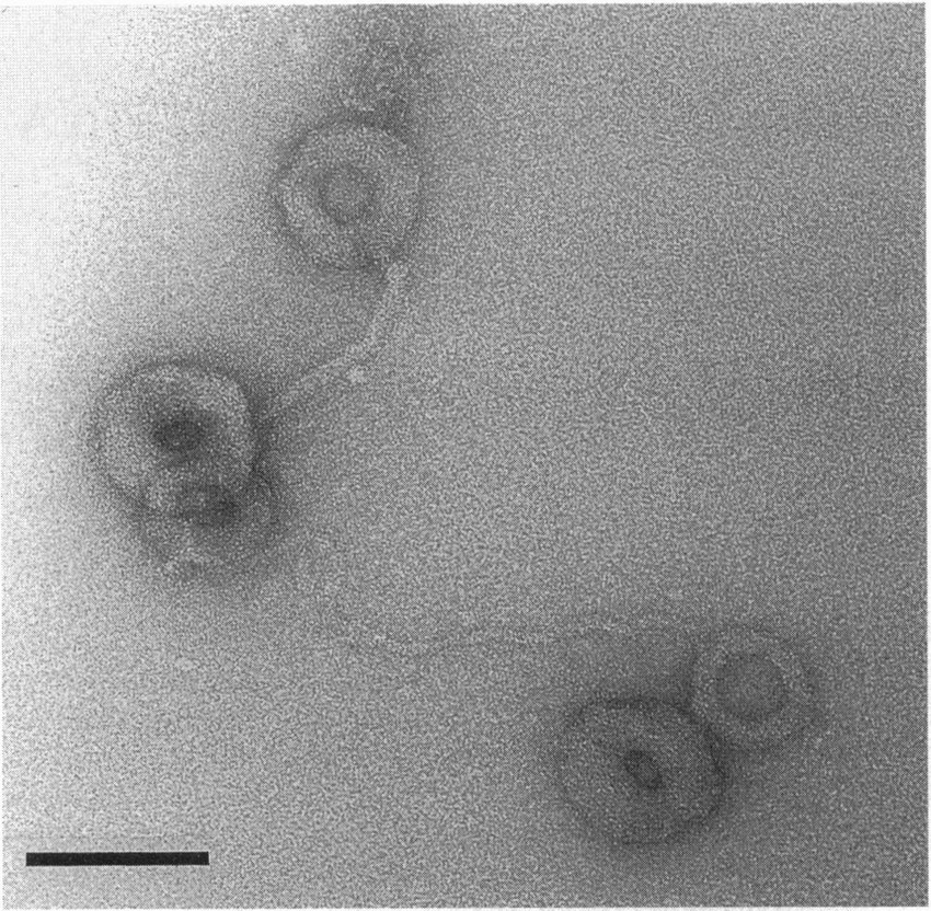 Navigating the Paradigm: Torus Plasma Domains